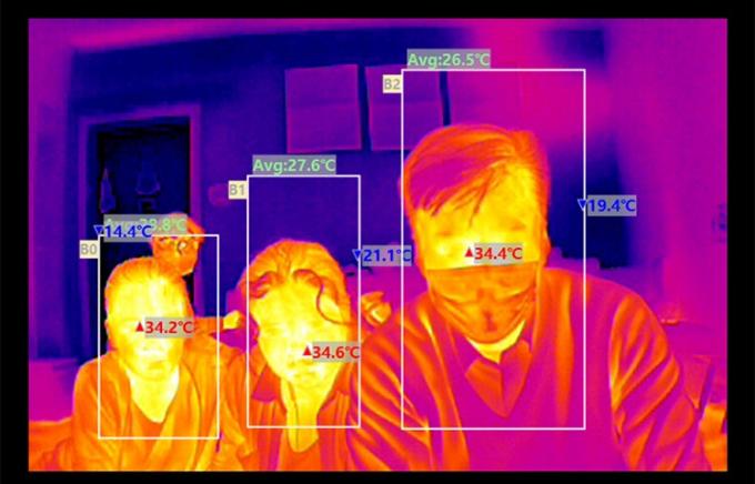 Black Body Long Range Thermal Camera Human Body Temperature Measurement ...